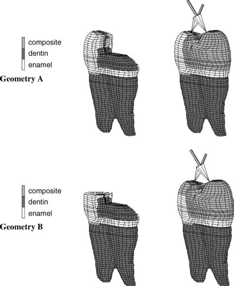 Three Dimensional Finite Element Fe Model Of A Maxillary Premolar
