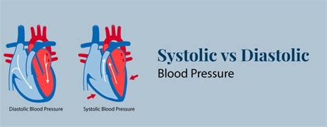 Systolic Vs Diastolic Blood Pressure Key Differences Explained
