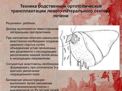 Трансплантация печени презентация онлайн