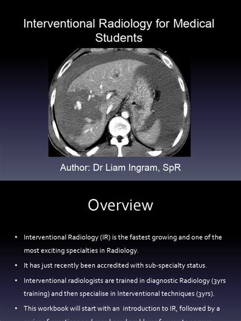 Intervention Module Download Free Pdf Interventional Radiology Radiology