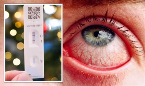 Covid Symptoms The Rare Sign Of Infection In Your Eye Could You Be