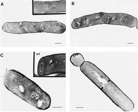 Electron Micrographs Of Representative Examples Of Septum Morphologies