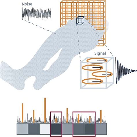 Different Types Of Array Coil Combinations A Parallel Array B Download Scientific Diagram