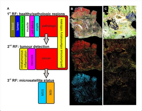Advances In Digital Pathology From Artificial Intelligence To Label Free Imaging Pmc