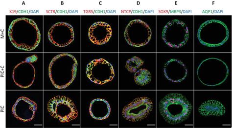 Chemically Defined Organoid Culture System For Cholangiocyte Differentiation Pmc