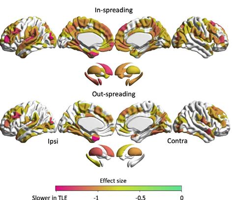 Altered Communication Dynamics Reflect Cognitive Deficits In Temporal Lobe Epilepsy