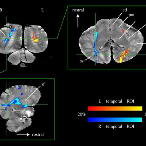 Pdf Diffusion Tensor Imaging Of Dolphin Brains Reveals Direct