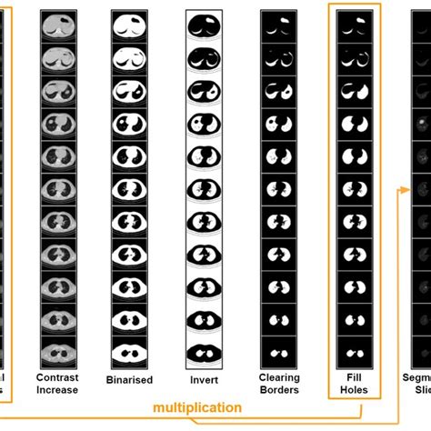 Pulmonary Segmentation Process Note That Each Row Denotes Partial Download Scientific Diagram