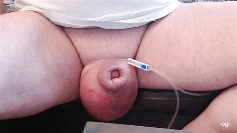 Saline Filled Scrotum Image 5102063 Thisvid Tube