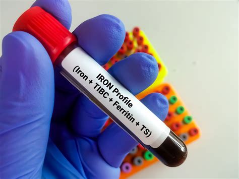 Iron Studies Iron Tibc Ts