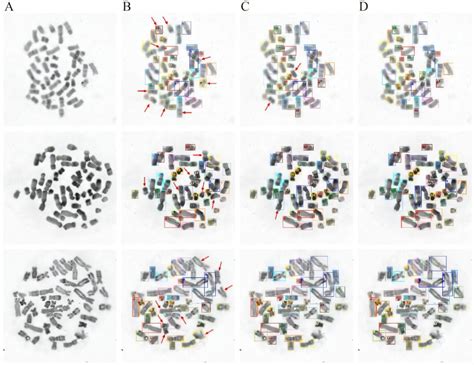 Enhancing Chromosome Detection In Metaphase Cell Images