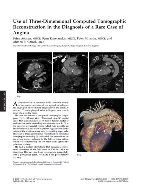 Pdf Use Of Three Dimensional Computed Tomographic Reconstruction In The Diagnosis Of A Rare