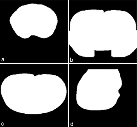 Segmentation Masks For The First Slice Of Each Volumetric Mr Data Set Download Scientific