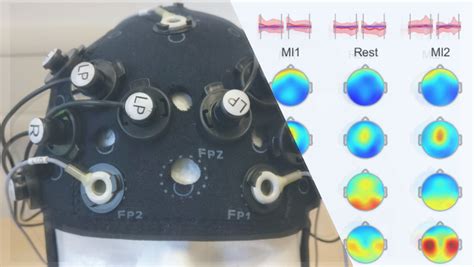 Hybrid Brain Computer Interface For Communicating With Patients With Locked In Syndrome Caused