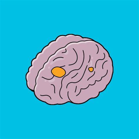 Pituitary Disease End West