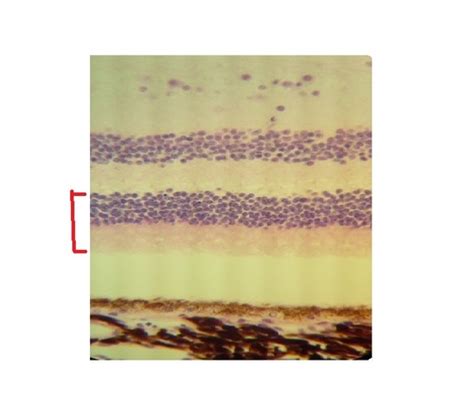 Lab Exam Histology Digestive Special Senses Flashcards Quizlet