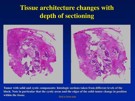 Ppt Requirements For Good Tissue Microarray Tma Results Powerpoint