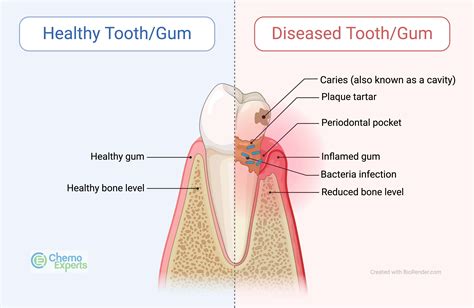 Toothache Chemoexperts