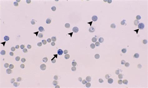 Reticulocyte Morphology And Maturation Flashcards Quizlet