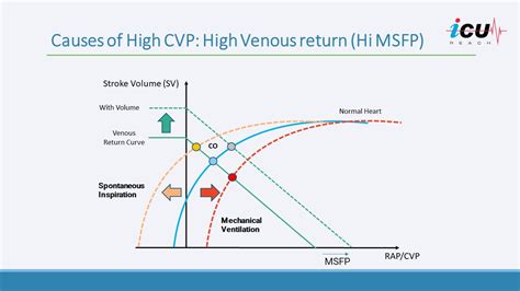 Basic Physiology In Hemodynamics Icu Reach