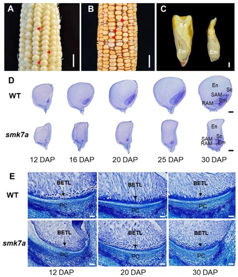 Characterization And Transcriptome Analysis Of Maize Small Kernel Mutant Smk7a In Different