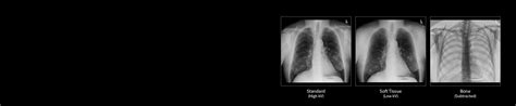 Dual Energy Subtraction Ge Healthcare
