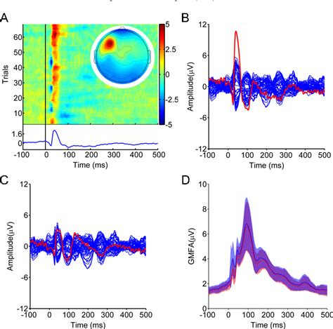 Figure 4 From Removing Artefacts From Tms Eeg Recordings Using Independent Component Analysis