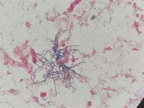 Nocardia Sp R Microbiology