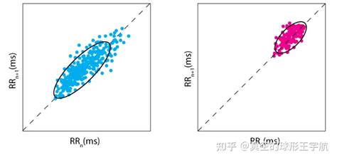 Hrv心率变异性：定义、理解以及应用 知乎