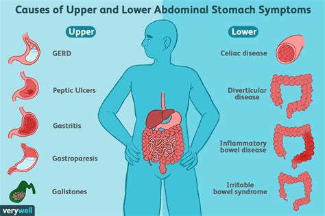Types Of Digestive Diseases And Disorders