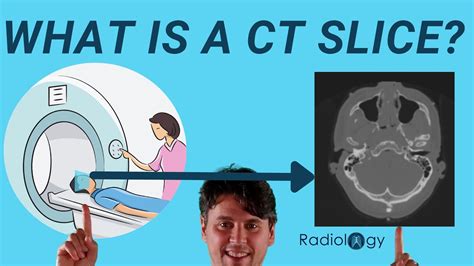 What Is Pitch In Ct Scan At Declan Gleadow Blog