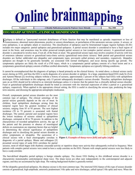 Issues In Brainmapping Eeg Quantification Basic Methodology Pdf