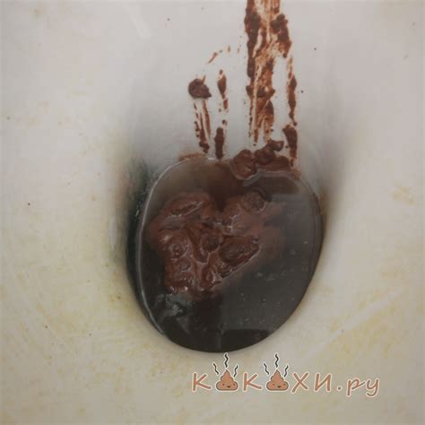 Случайно ночью обосрался в трусы Тяжелые роды