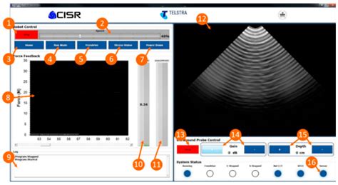 Haptiscan A Haptically Enabled Robotic Ultrasound System For Remote Medical Diagnostics