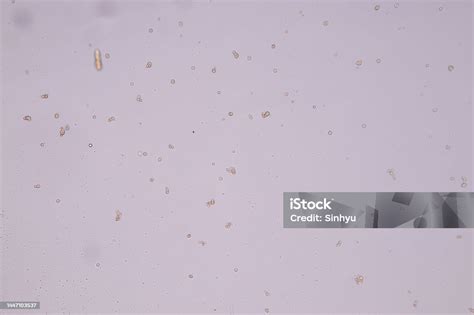 Slime Molds As A Group Are Polyphyletic Under The Microscope For