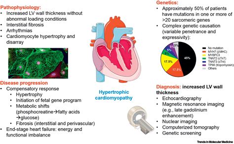 Ejection Fraction Hypertrophic Cardiomyopathy At Lucy Hynes Blog