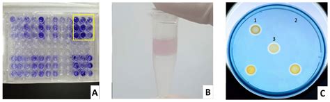 Prevalence And Virulence Of Commensal Pseudomonas Aeruginosa Isolates