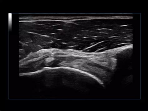 Mylab™omega Exp A New Standard For Portable Ultrasounds Esaote