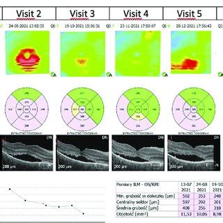 Changes In Retinal Morphology In The Course Of CSCR In The RE Download Scientific Diagram