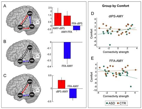 Dynamic Causal Modelling Dcm Posterior Parameter Estimates For The