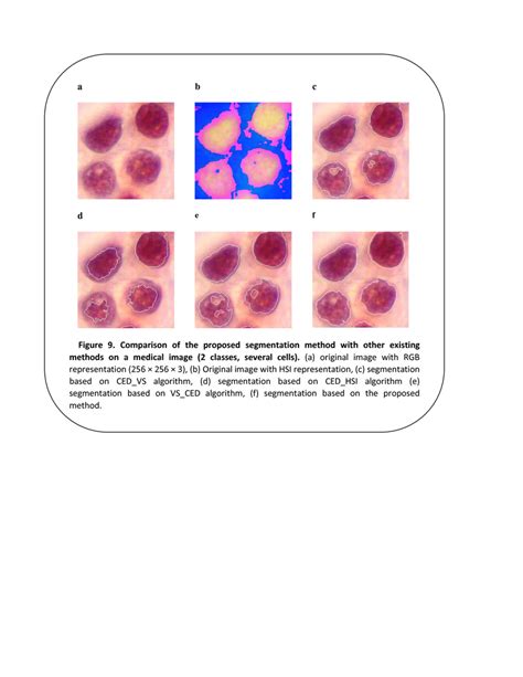 Edge Detection Performance Comparisons For Cells Image A Original