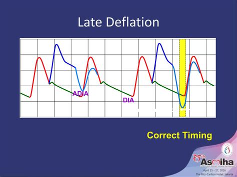 Iabp Principle Hemodynamic Timing Weaning 2016 Background Asmiha