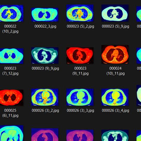 Chest Ct Scan Medical Imaging Colorized Dataset Kaggle