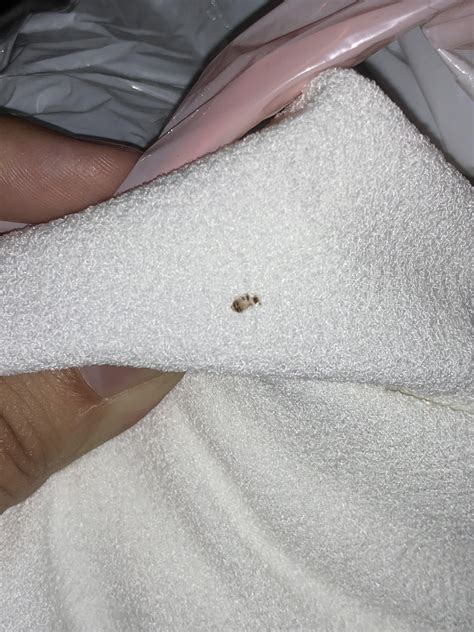 I Found This Bed Bug Exoskeleton On A Dress In My Apartment But The Dress Had Been In My Car For
