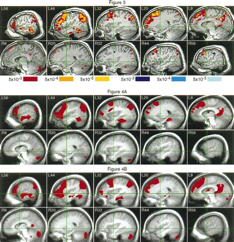 Bottom Reproducibility Of Fmri Language Activations Areas Activated Download Scientific