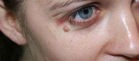 Warts And All
