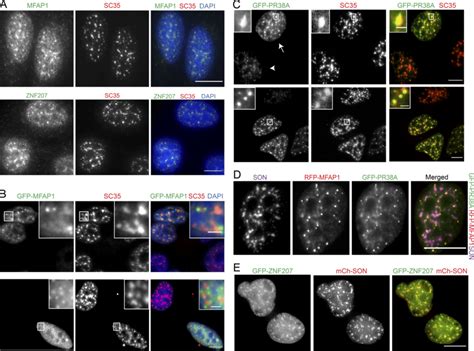 Microscopy Validation Of Proteins With A High Spk Cen Ratio A