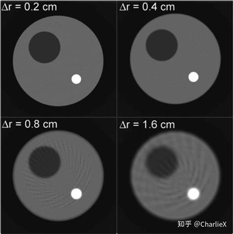Filter Backprojection FBP 知乎