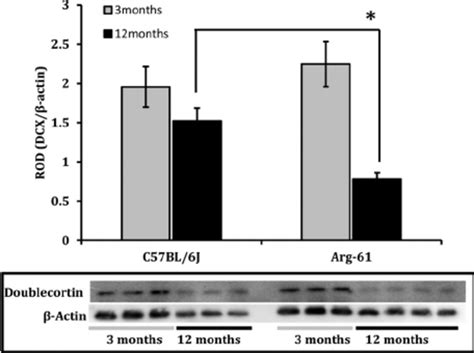 Decreased Doublecortin Levels Later In Life In Old Arg 61 Mice Download Scientific Diagram
