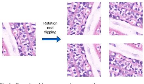 Figure 3 From Histopathological Gastric Cancer Detection Using Transfer